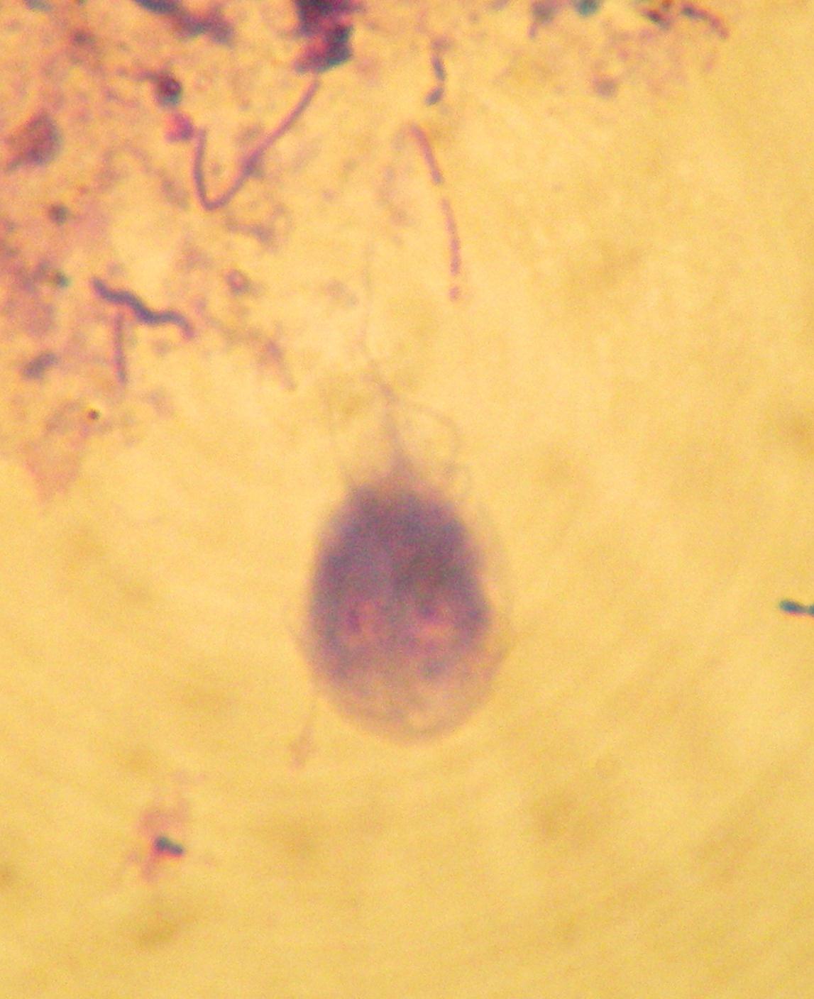 Giardiose | Tierhilfe Spanien e.V.